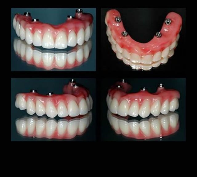 Tratamentos - Dr. Diego César Ortodontia e Implantes - Patos de Minas/MG